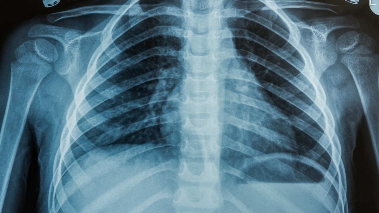 X-Rays – Big Sky Imaging